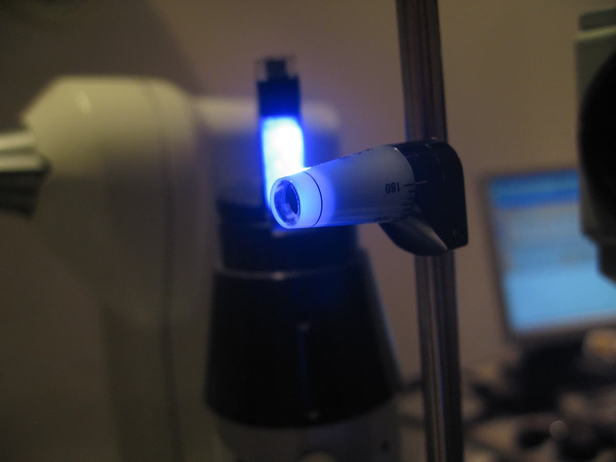 Kahook Dual Blade Goniotomy | Treatment Guide | Kerbside